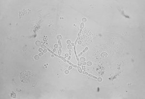 Genitalpilz (Soor, Candidose) – LIEBE, MIT SICHERHEIT BESSER